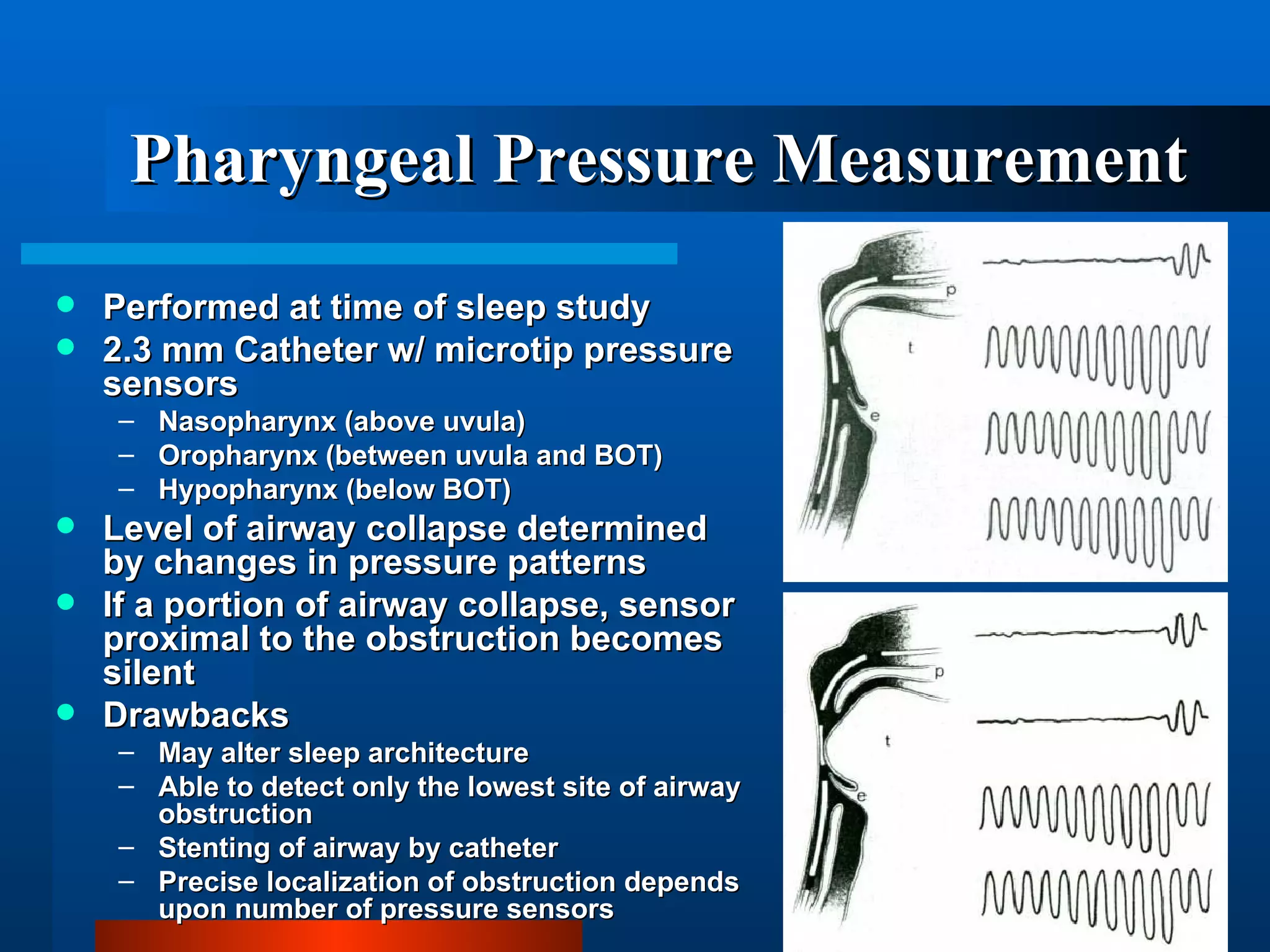 Preop Assessment Periop Management | PPT