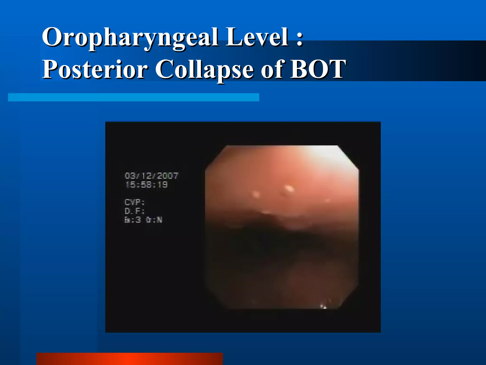 Preop Assessment Periop Management | PPT