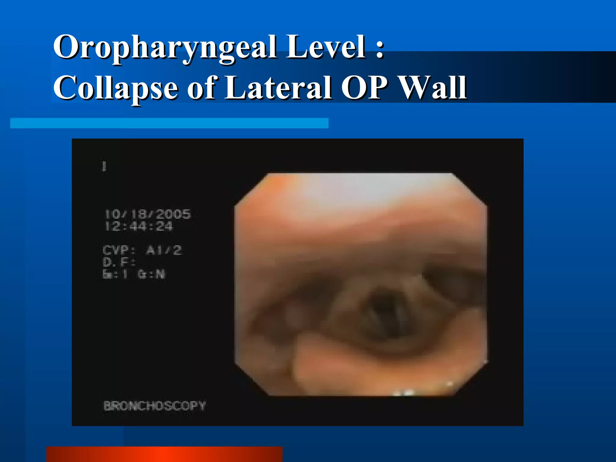 Preop Assessment Periop Management | PPT