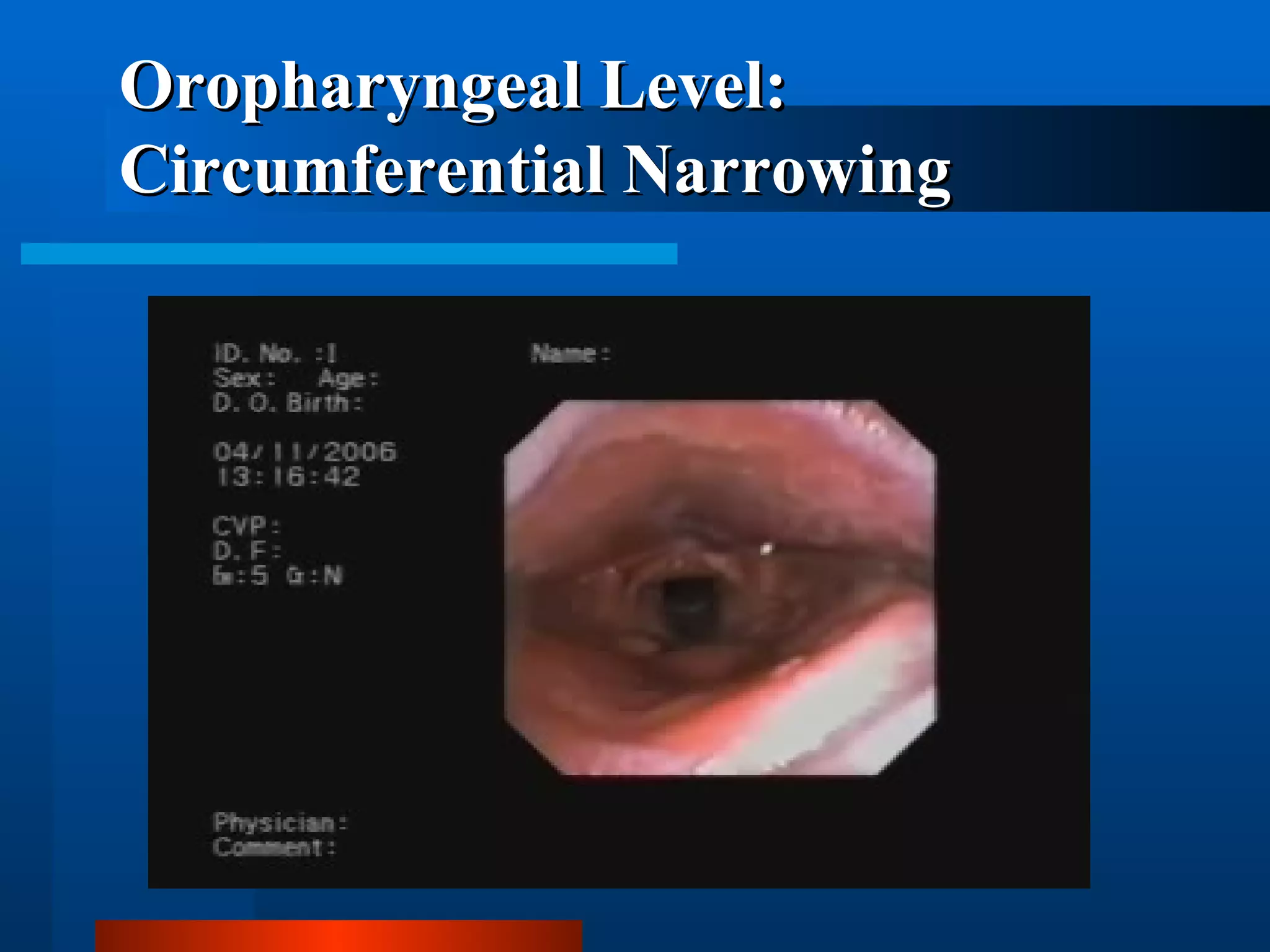 Preop Assessment Periop Management | PPT