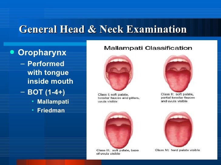 Preop Assessment Periop Management