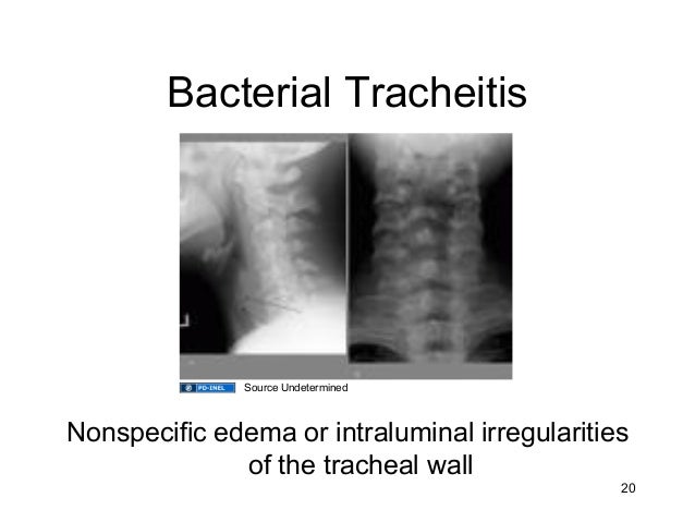 GEMC: ENT Case Files: Resident Training