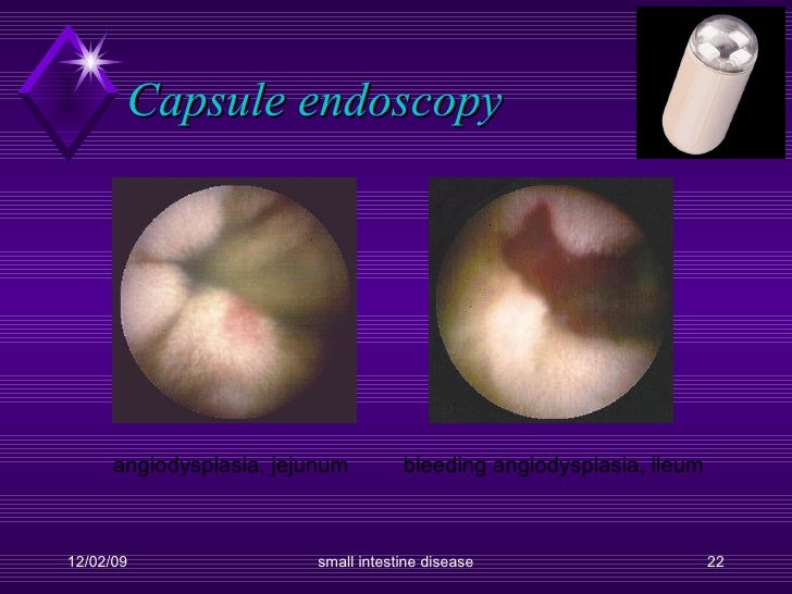 small intestine diseases 2