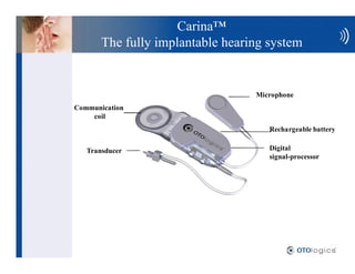 Carina – the fully implantable hearing solution-eng 2009-09-04 | PPT