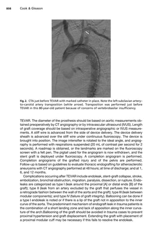 2009 Great vessel and cardiac trauma | PDF
