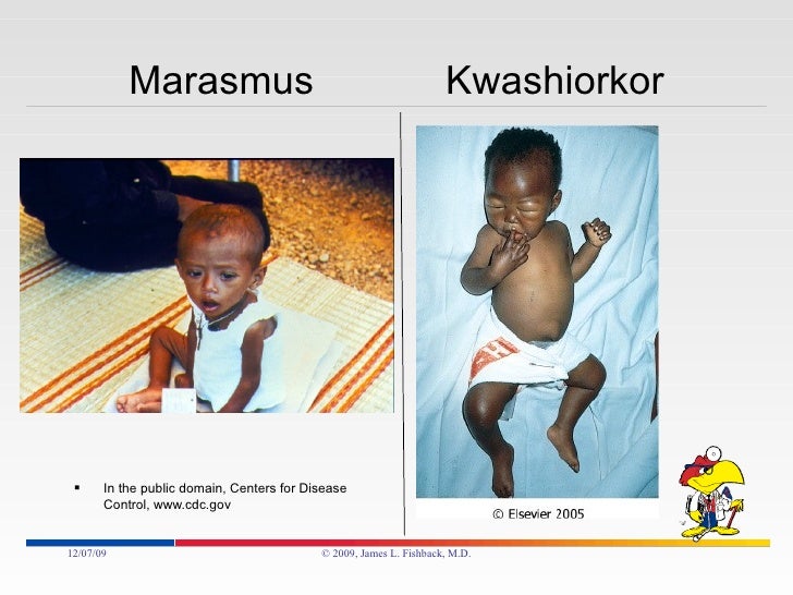 Nutritional Pathology