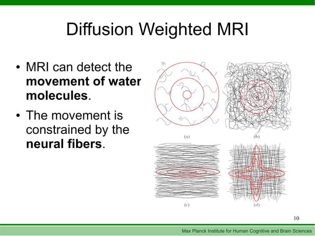 Diffusion MRI, Tractography,and Connectivity: what machine learning can ...