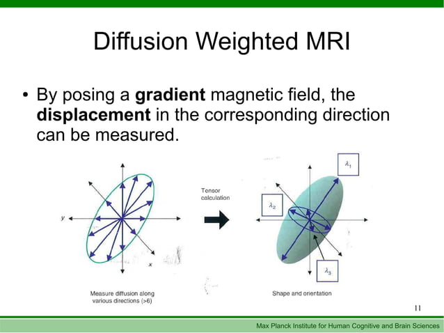 Diffusion MRI, Tractography,and Connectivity: what machine learning can ...