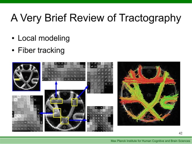 Diffusion MRI, Tractography,and Connectivity: what machine learning can ...