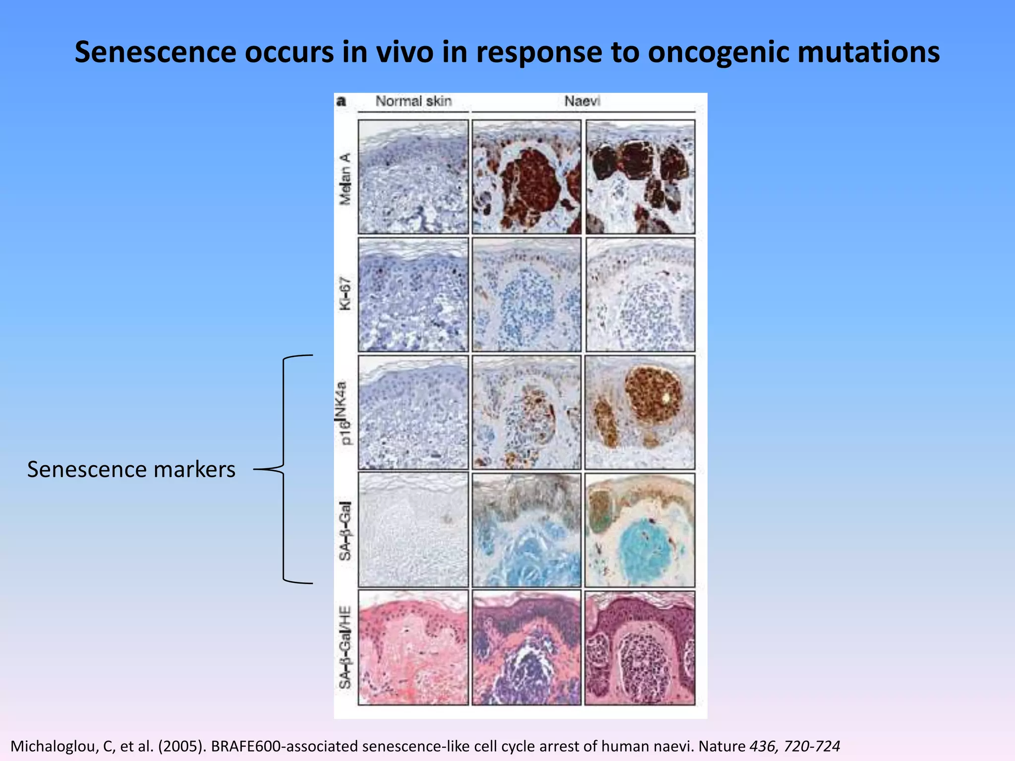 Tumor suppression and inflammation: controlling the senescence associated secretory phenotype ...