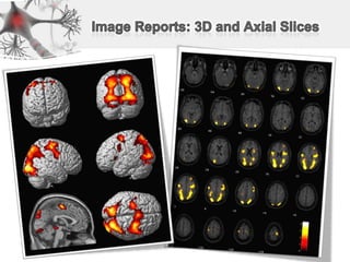 fMRI Brain Imaging | PPT