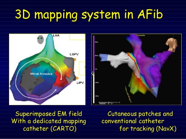 2009 bologna, workshop interattivo. strategie ablative nel trattament…