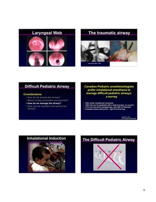 Managing the Difficult Pediatric Airway | PDF