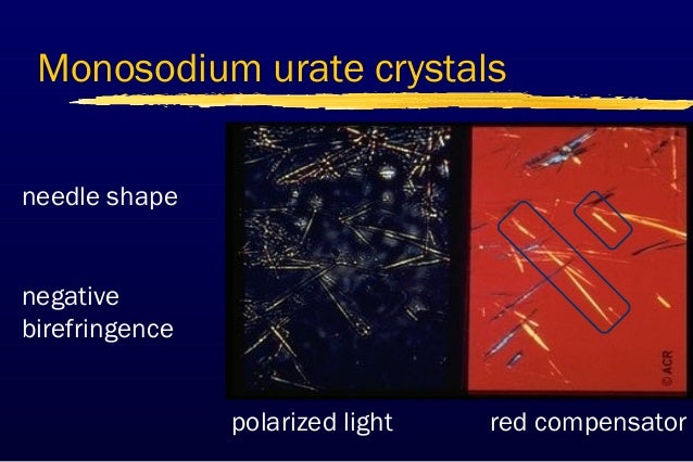 2009 gout pharmacology
