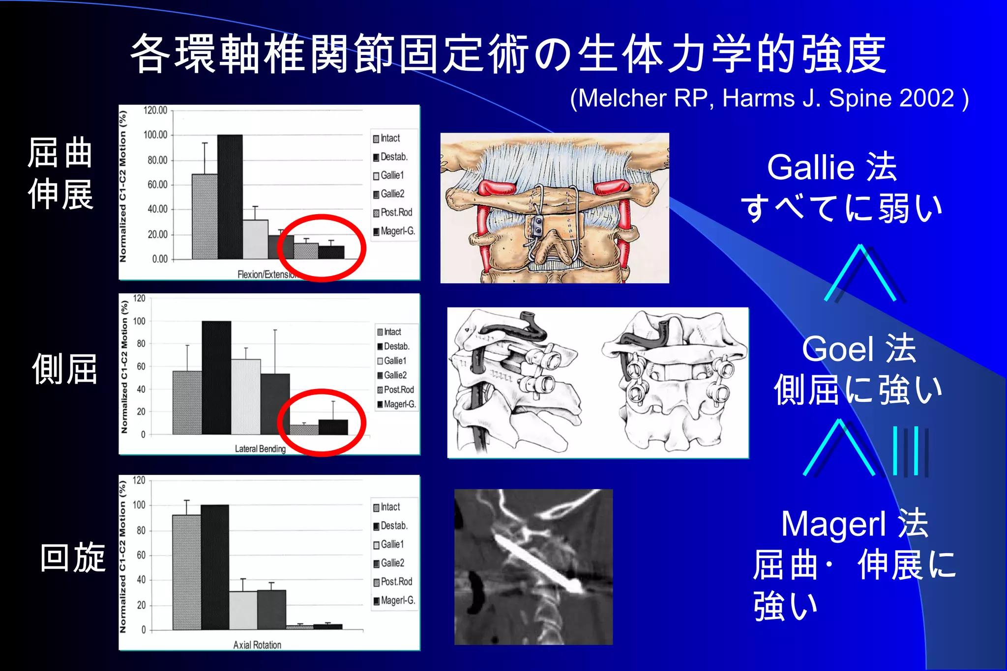 Atolantoaxial Spine 2009 JJSeminar | PPT