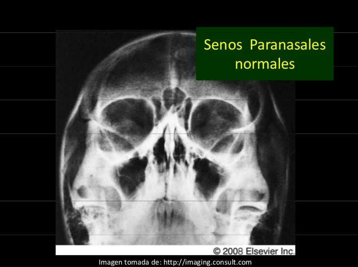 Senos Maxilares