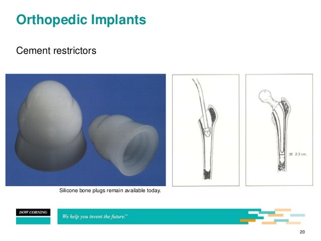 Silicone Biomaterial Applications: Past, Present and Future