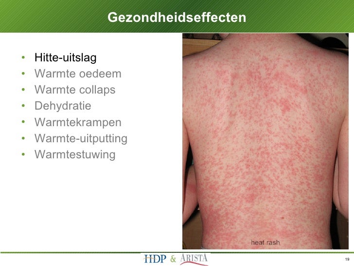 Werken in warme omstandigheden