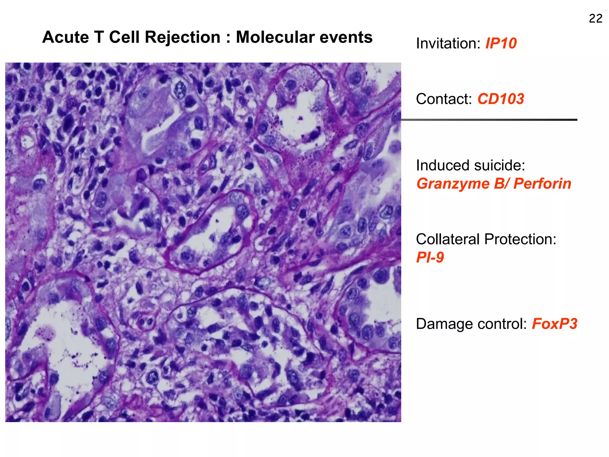 Non biopsy diagnosis of acute rejection of Renal allograft | PPT