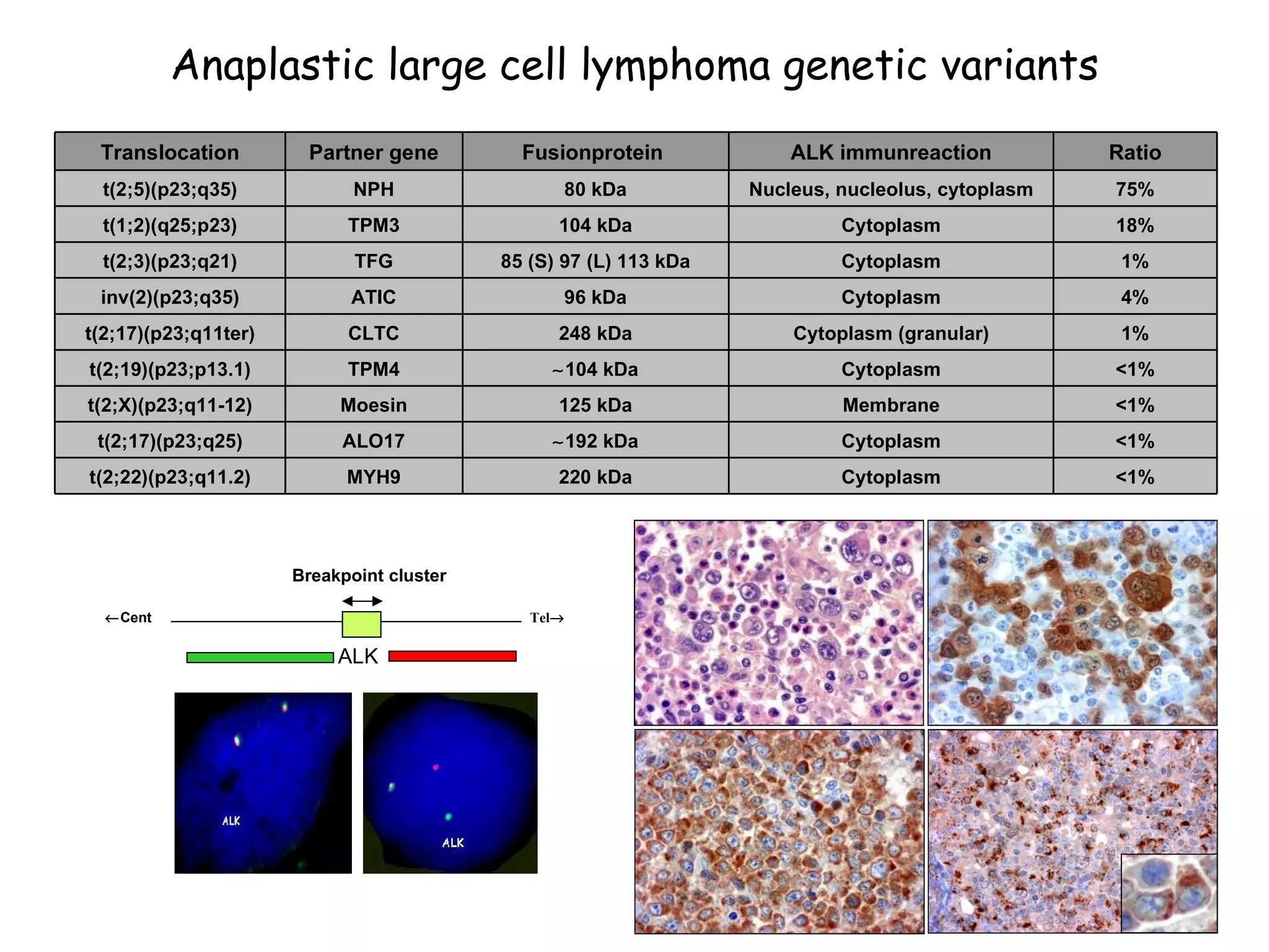 Modern classification of lymphomas (2010) VEAB presentation | PPT ...