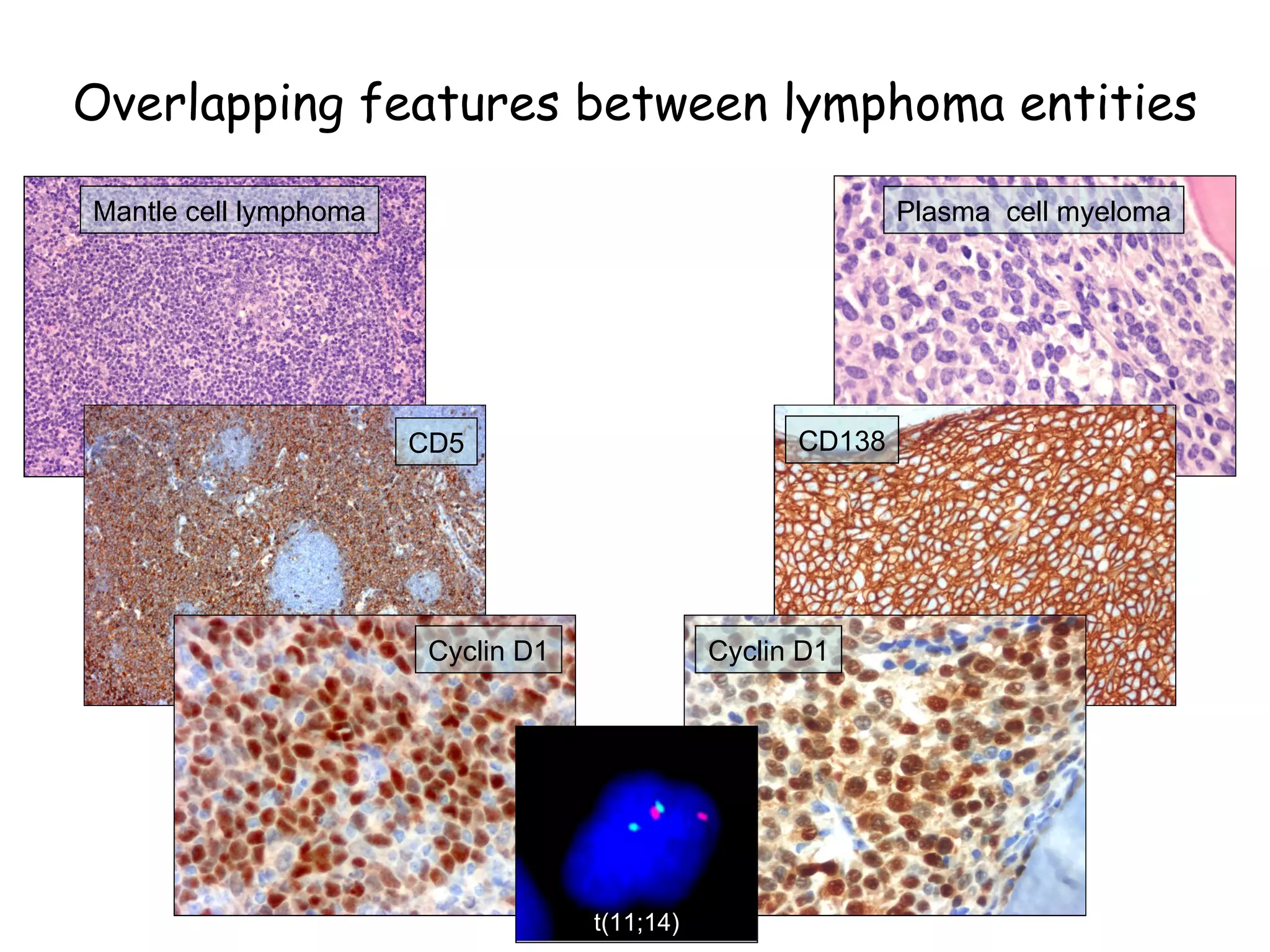 Modern classification of lymphomas (2010) VEAB presentation | PPT