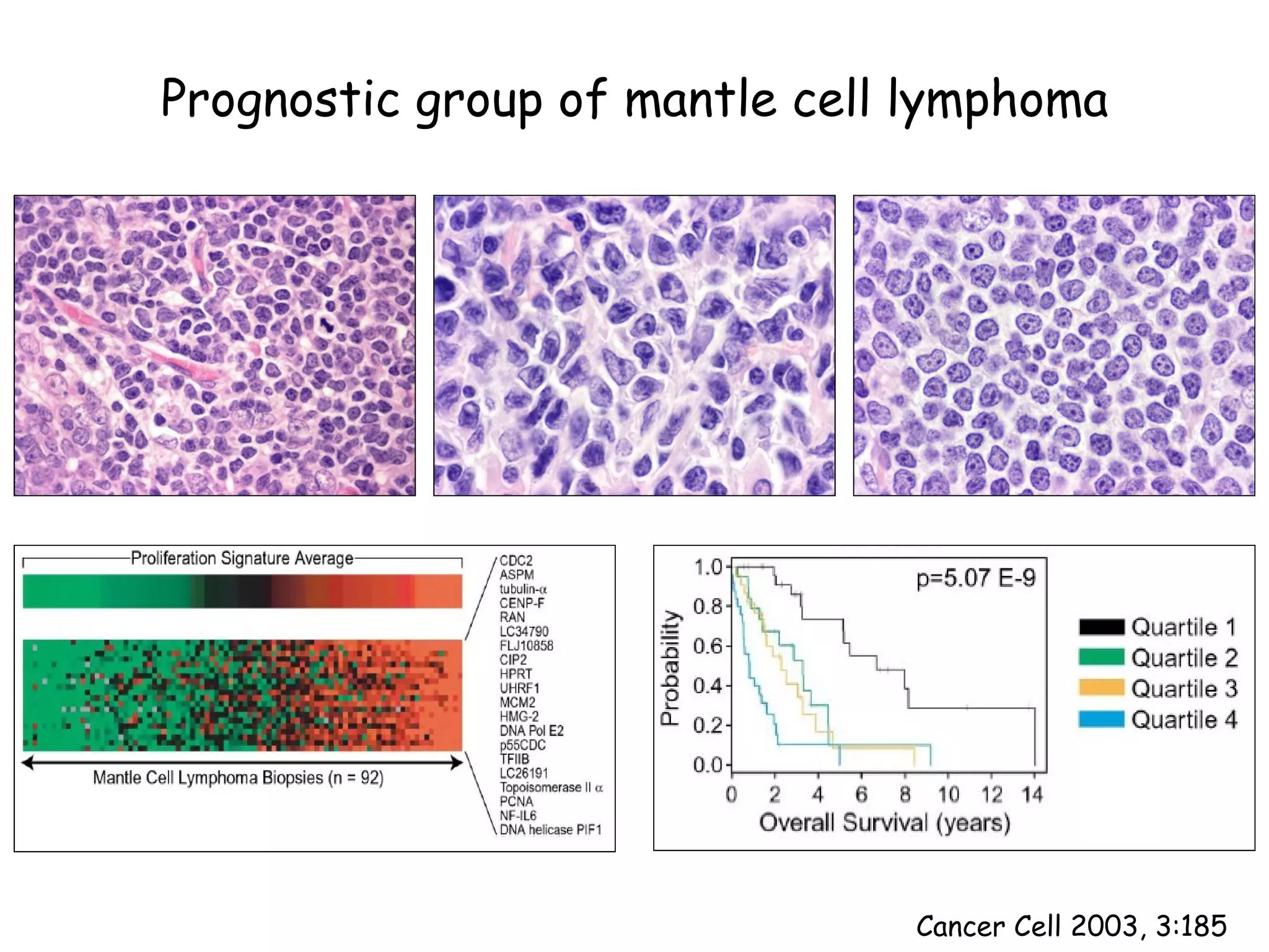 Modern classification of lymphomas (2010) VEAB presentation | PPT