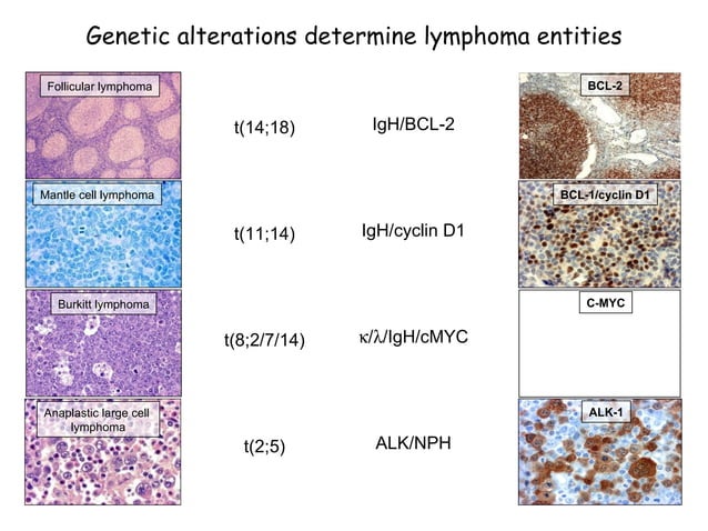 Modern classification of lymphomas (2010) VEAB presentation | PPT ...
