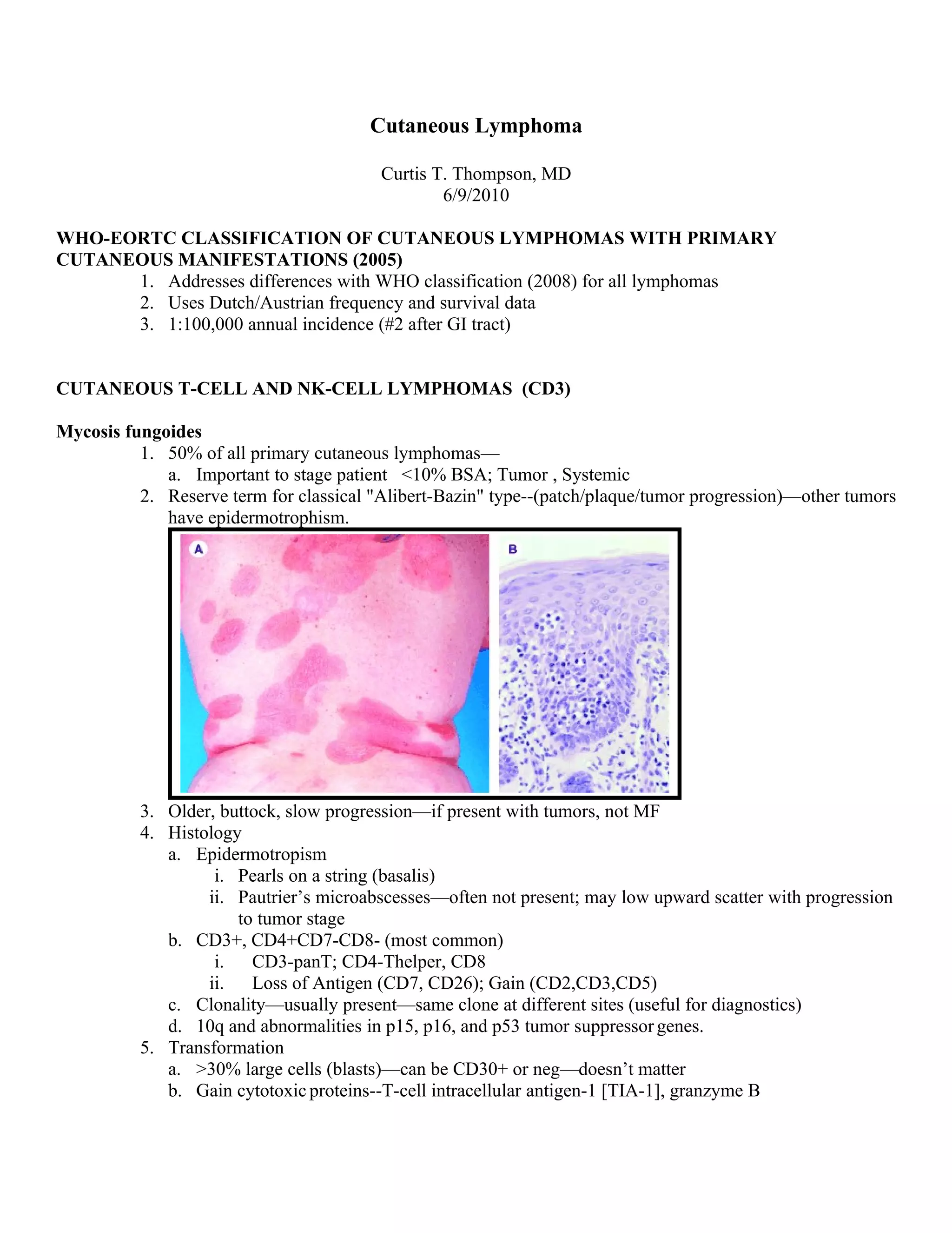 C. Thompson - Cutaneous Lymphoma | DOC
