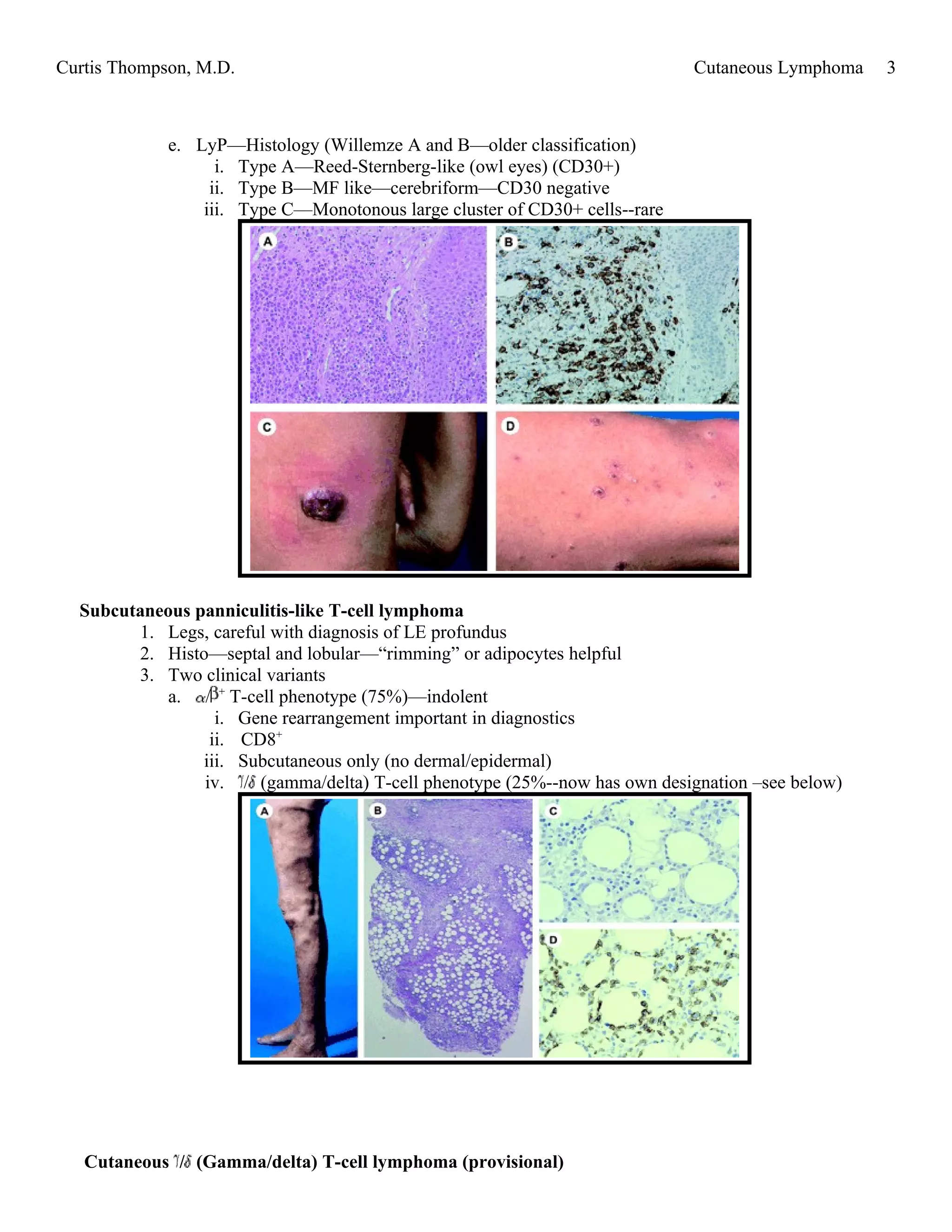 C. Thompson - Cutaneous Lymphoma | DOC