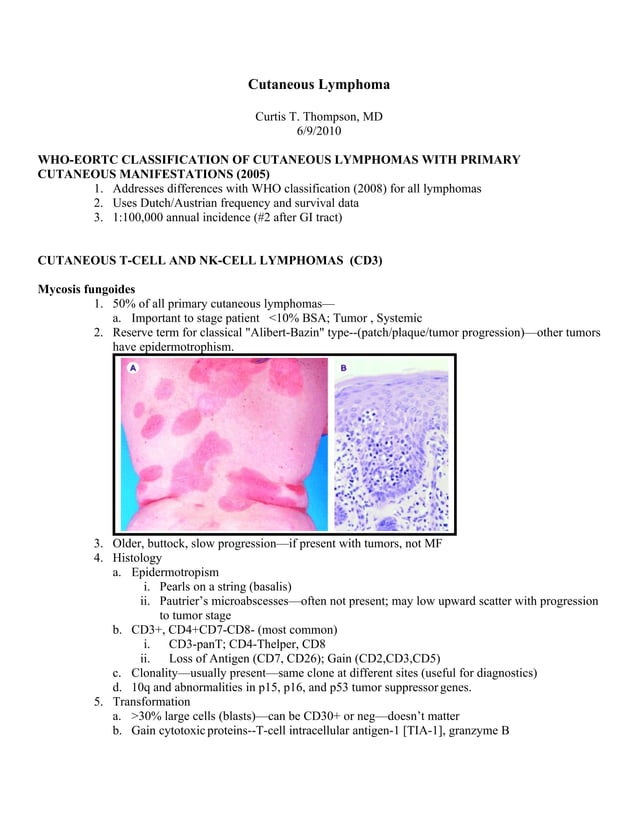 C. Thompson - Cutaneous Lymphoma | DOC