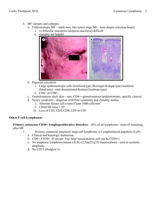 C. Thompson - Cutaneous Lymphoma | DOC