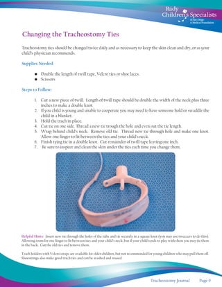Tracheostomy Journal | PDF