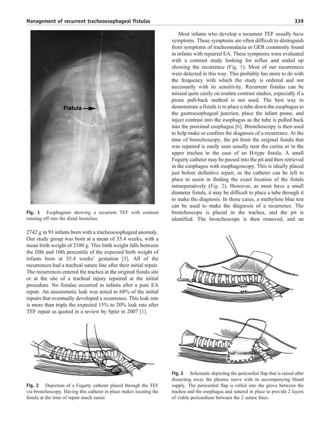 2010 the diagnosis and management of recurrent | PDF | Digestive ...