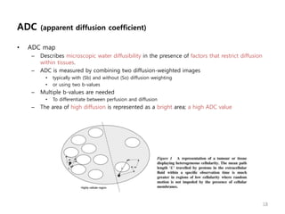 Diffusion Weighted MRI (2011-09-29 이정원) | PPTX