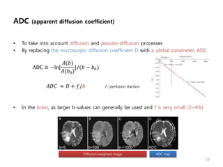 Diffusion Weighted MRI (2011-09-29 이정원) | PPTX