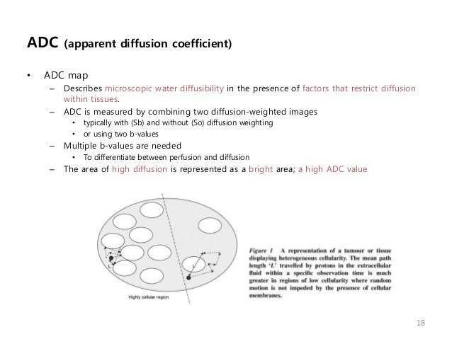 Diffusion Weighted MRI (2011-09-29 이정원)