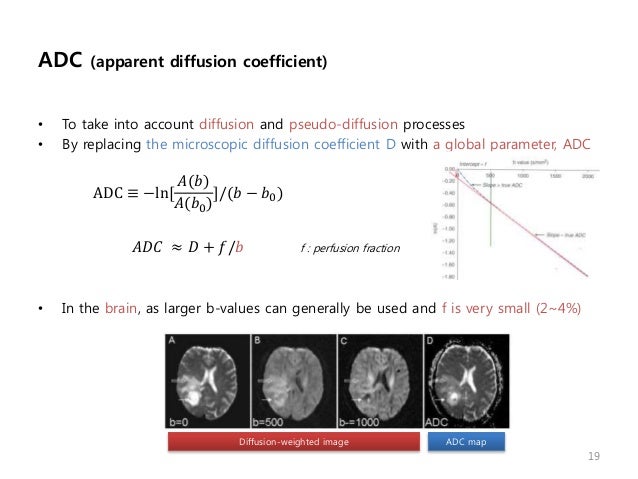Diffusion Weighted MRI (2011-09-29 이정원)