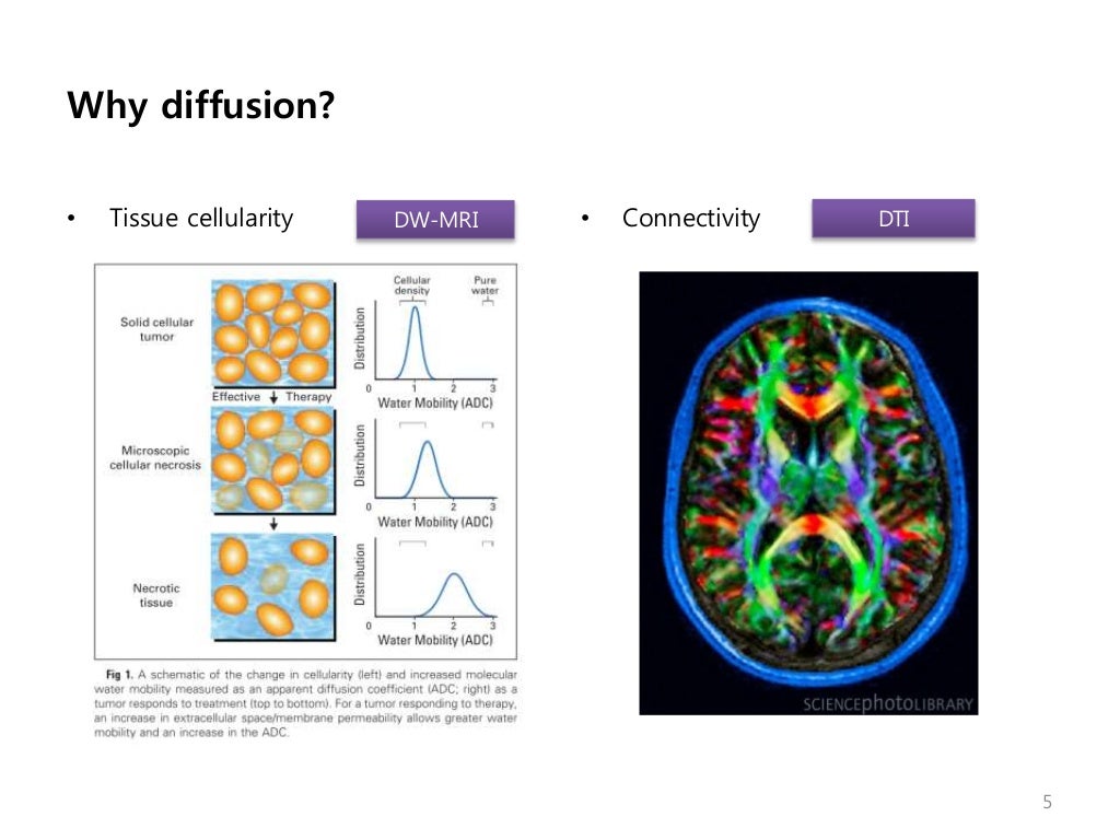 Diffusion Weighted MRI (2011-09-29 이정원)