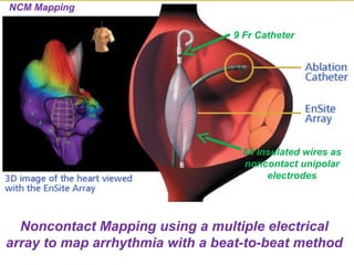 2011 10-sjm ncm svt | PPT