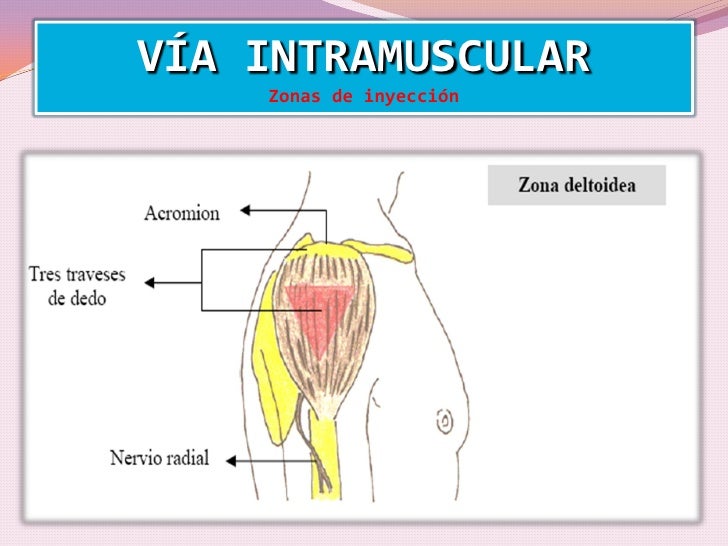 2011 2 via subcutanea e intramuscular