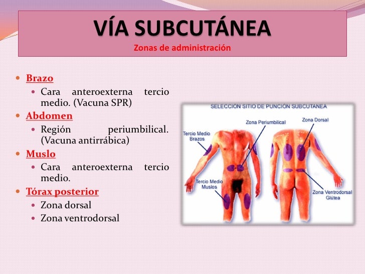 2011 2 via subcutanea e intramuscular