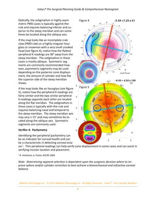 INTACS Nomogram | PDF