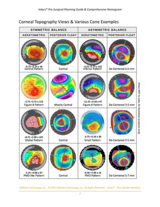INTACS Nomogram | PDF