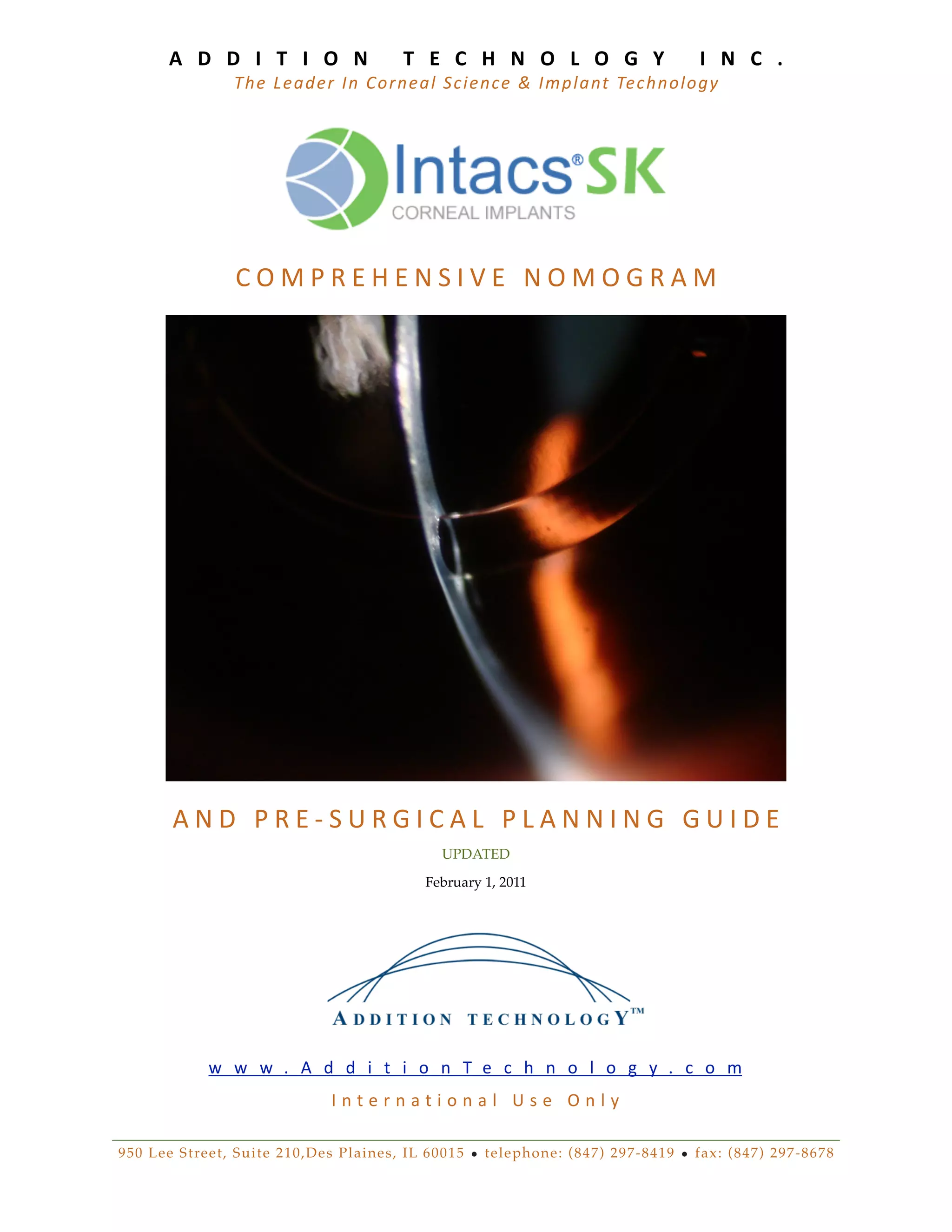 INTACS SK nomogram | PDF