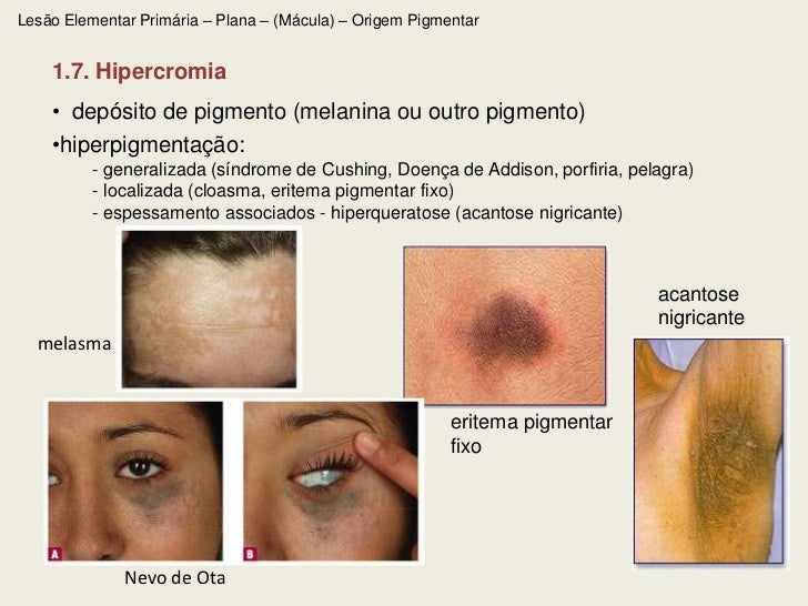 Introdução à dermatologia