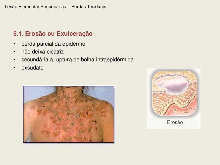 Introdução à dermatologia