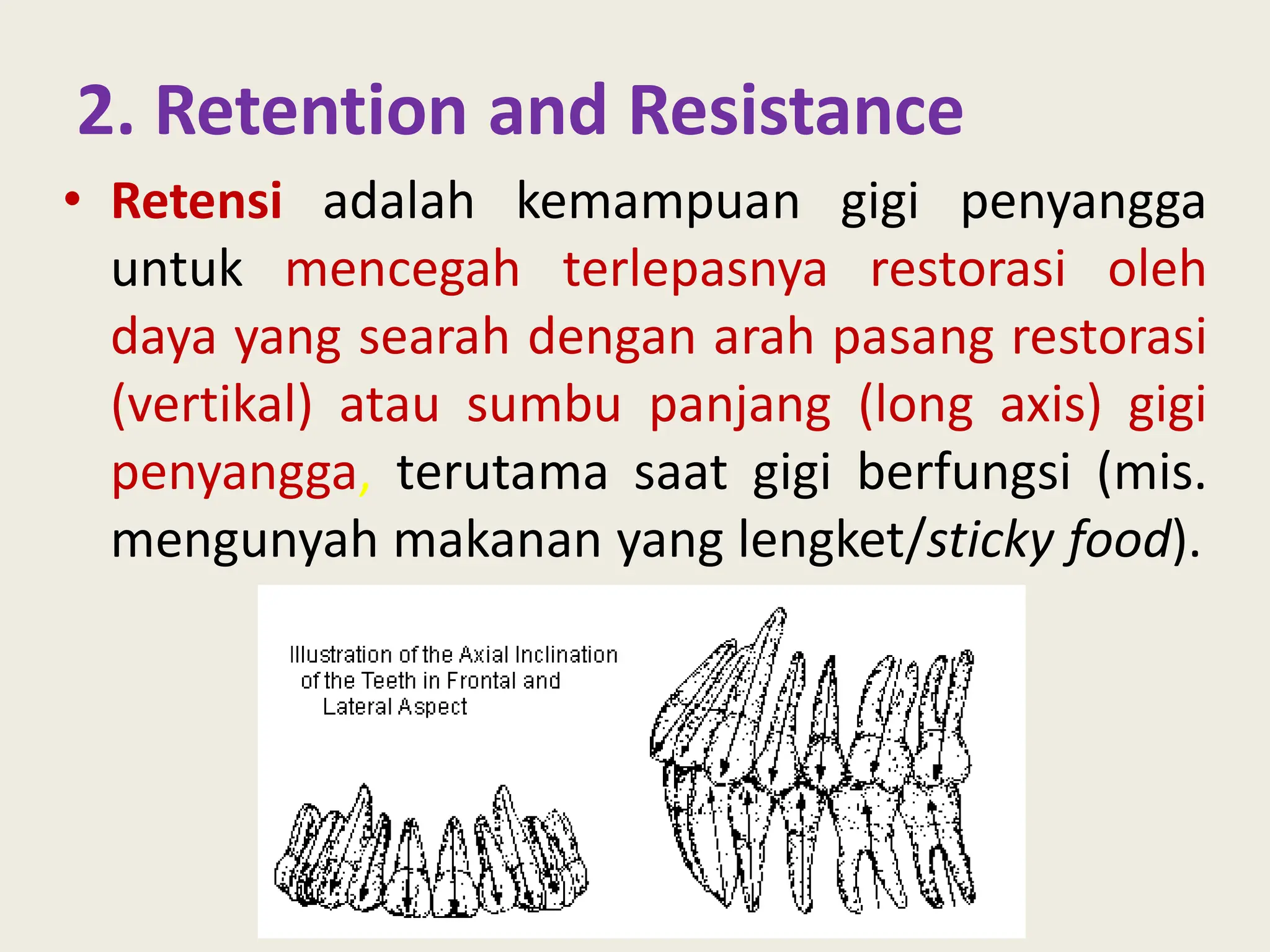 prinsip preparasi dalam pembuatan gigi tiruan jembatan | PDF