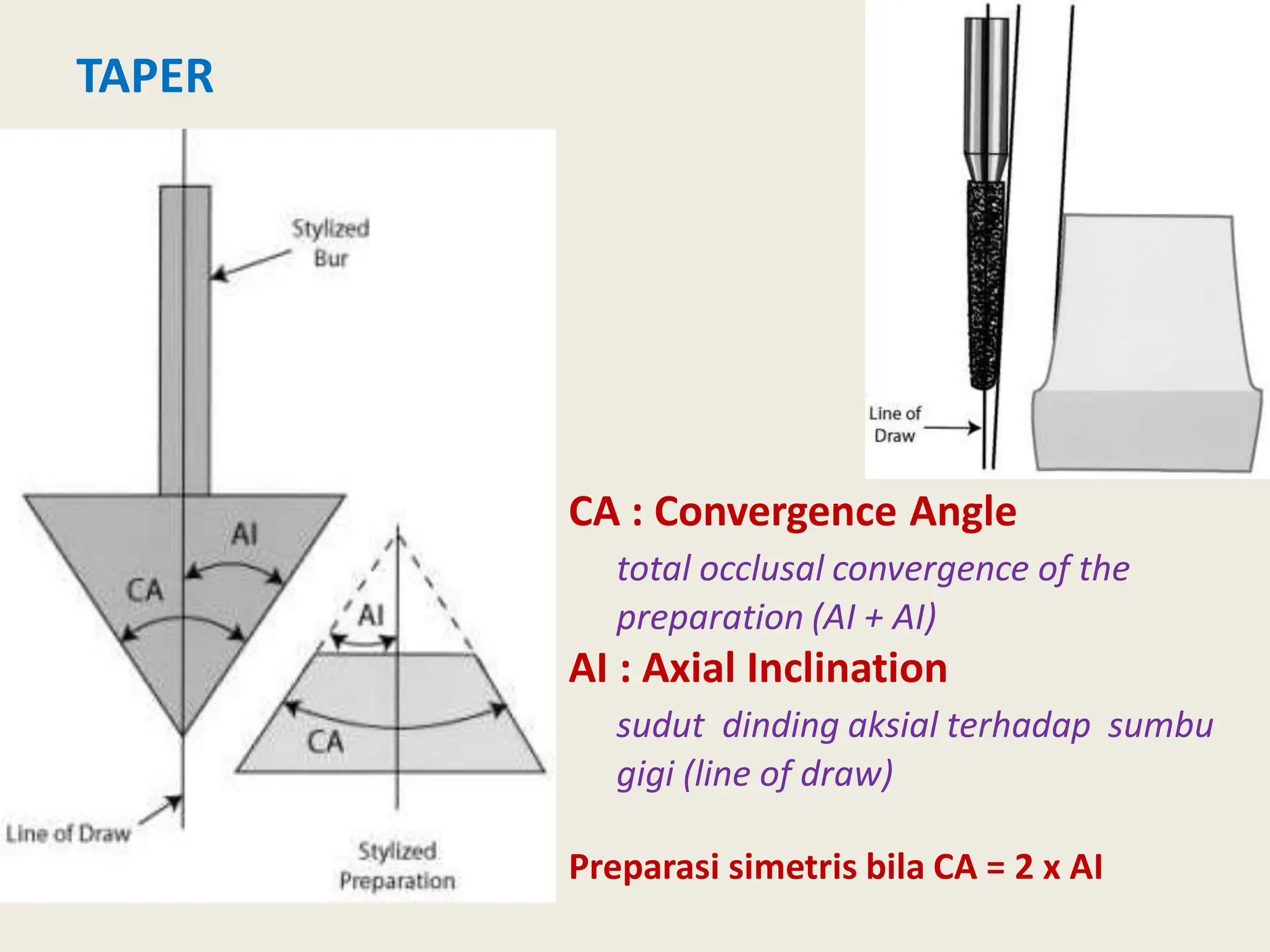 prinsip preparasi dalam pembuatan gigi tiruan jembatan | PDF
