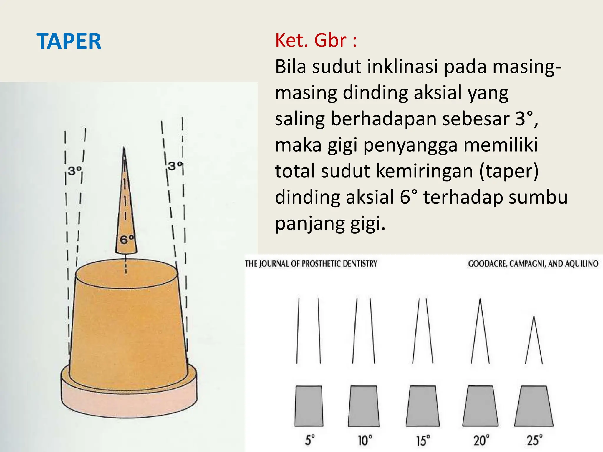 prinsip preparasi dalam pembuatan gigi tiruan jembatan | PDF