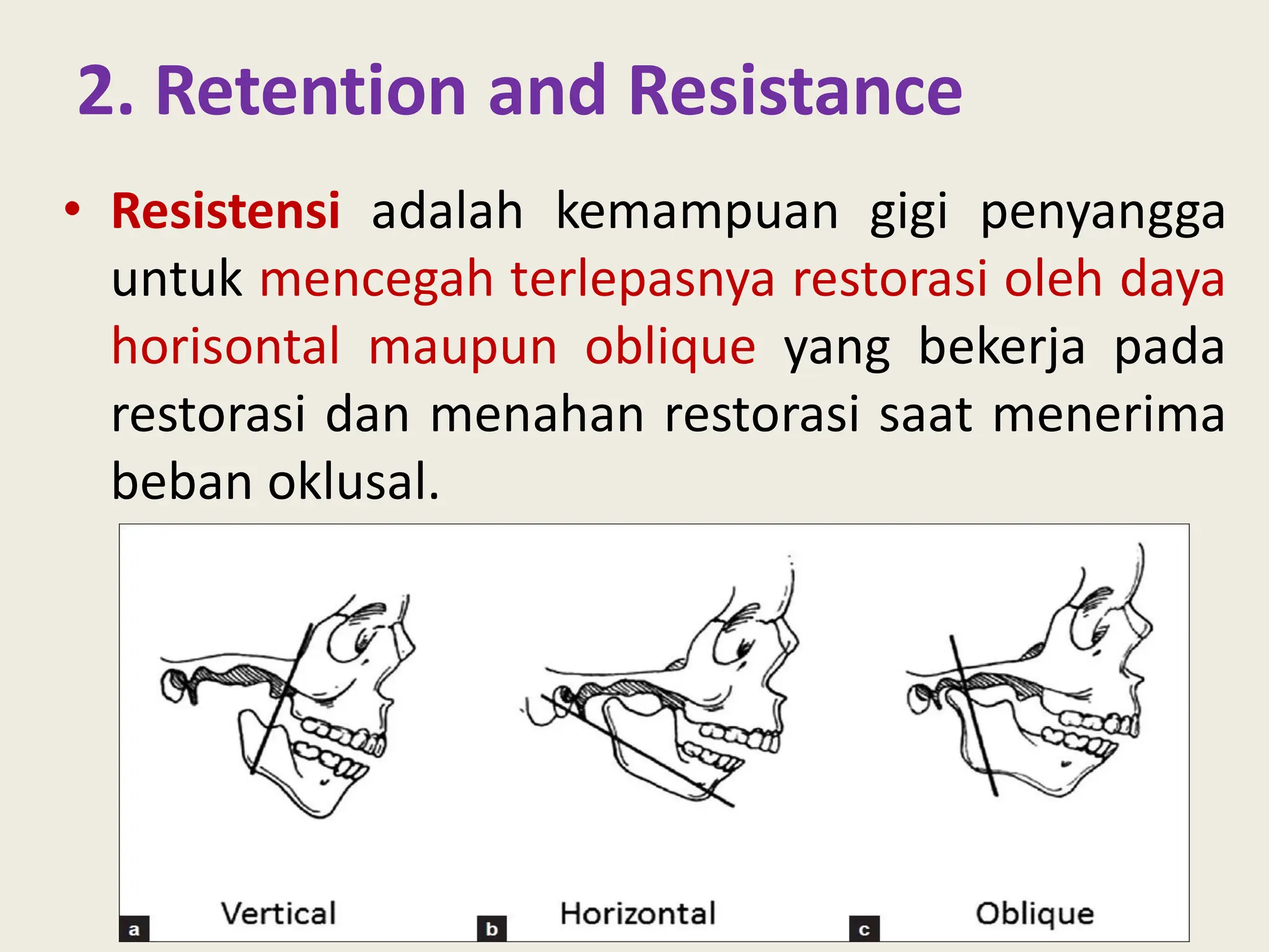 prinsip preparasi dalam pembuatan gigi tiruan jembatan | PDF